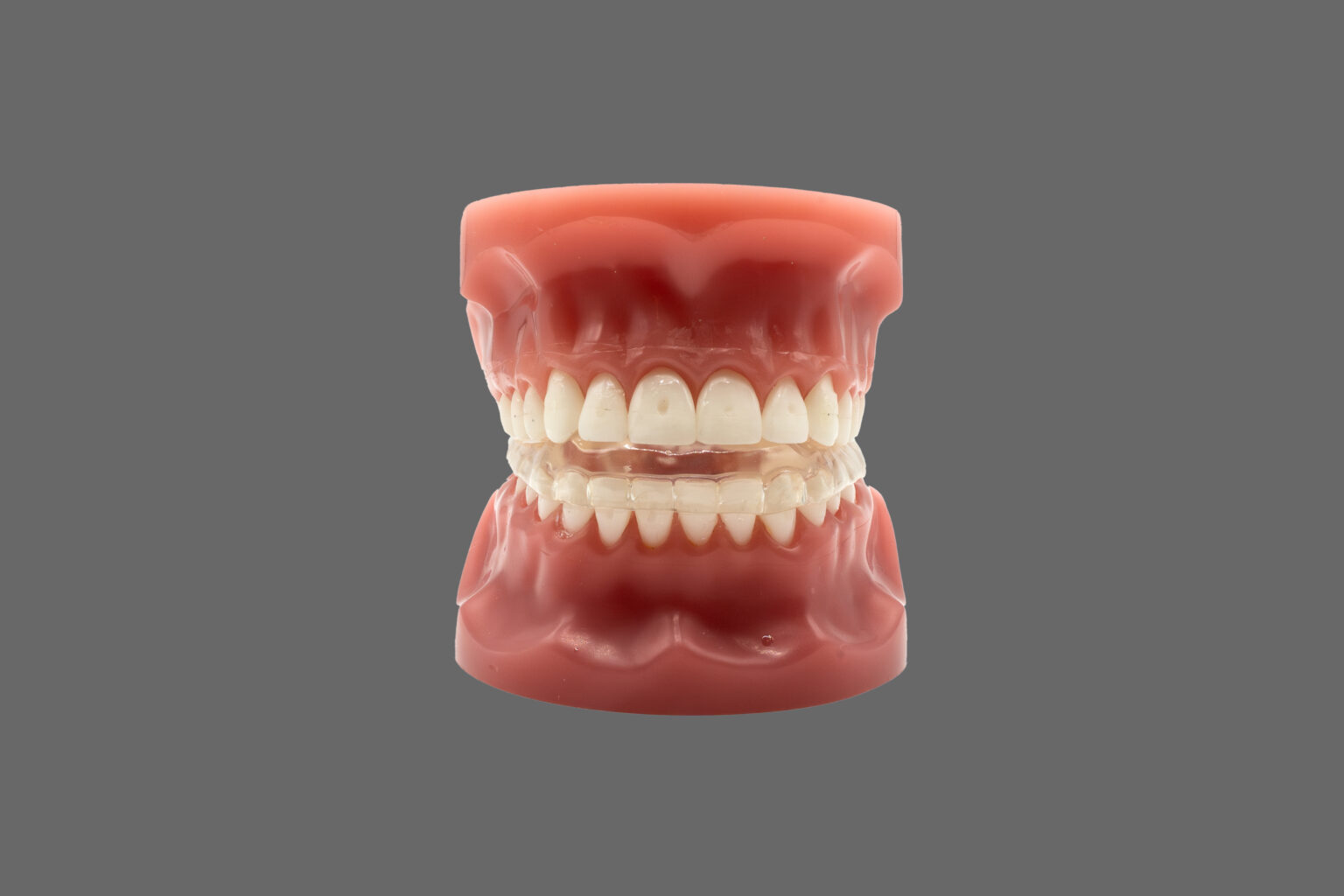 Occlusal Splints - Cardiff Ortho