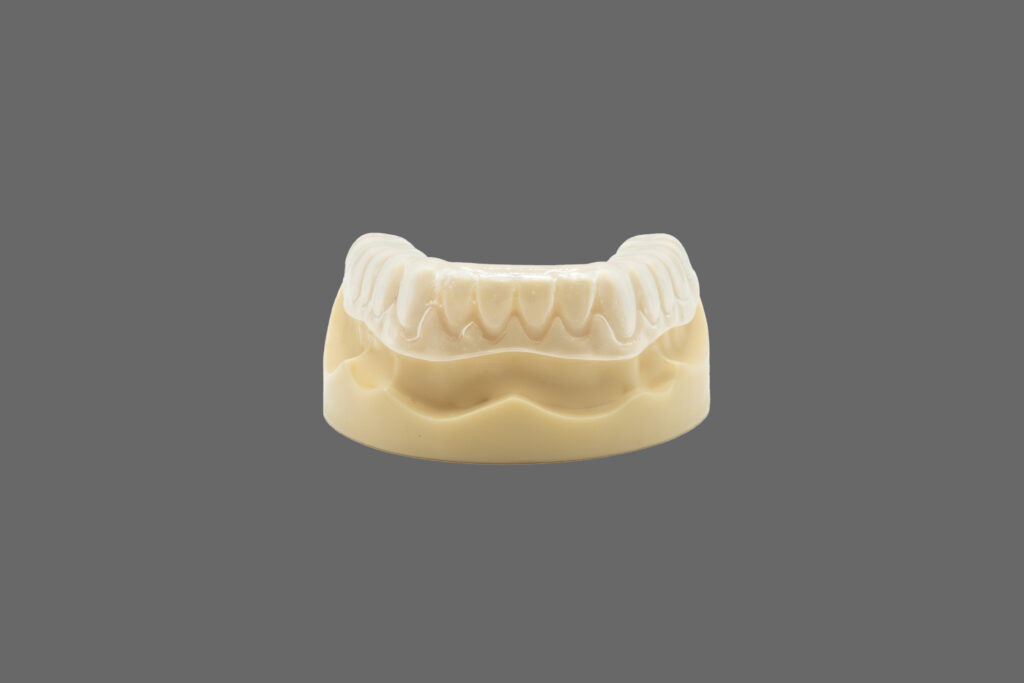 Occlusal Splints - Cardiff Ortho