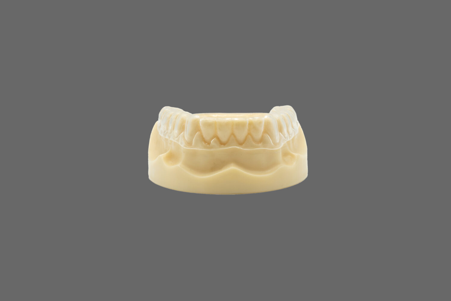 Deprogramming Splints - Cardiff Ortho