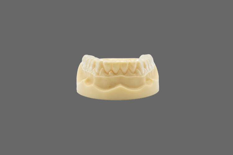 Occlusal Splints - Cardiff Ortho