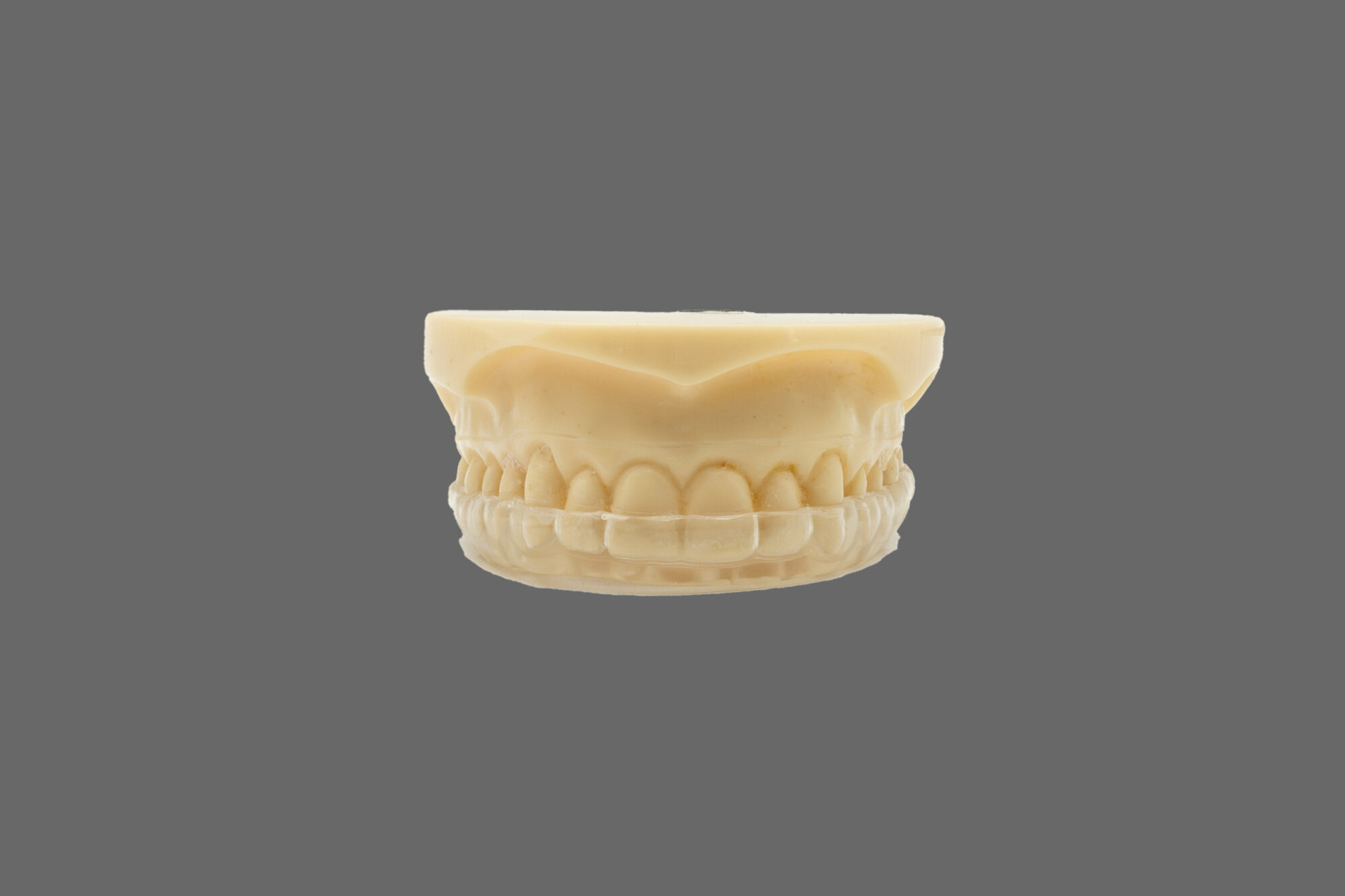 Hard Occlusal Splints - Flat Plane - Cardiff Ortho