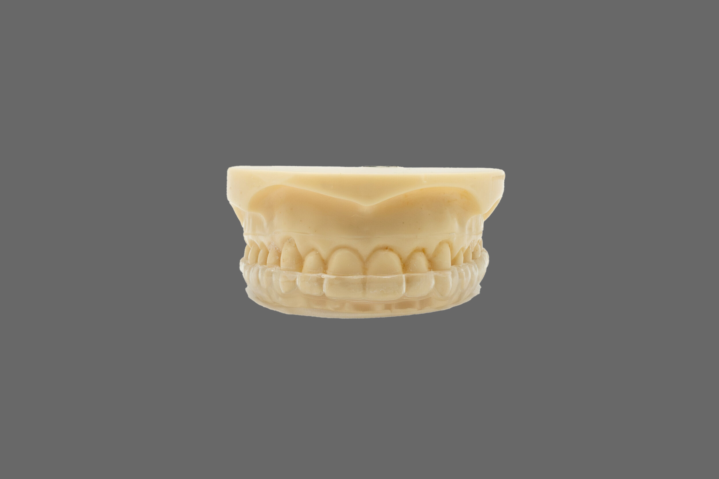 Hard Occlusal Splints - Flat Plane - Cardiff Ortho